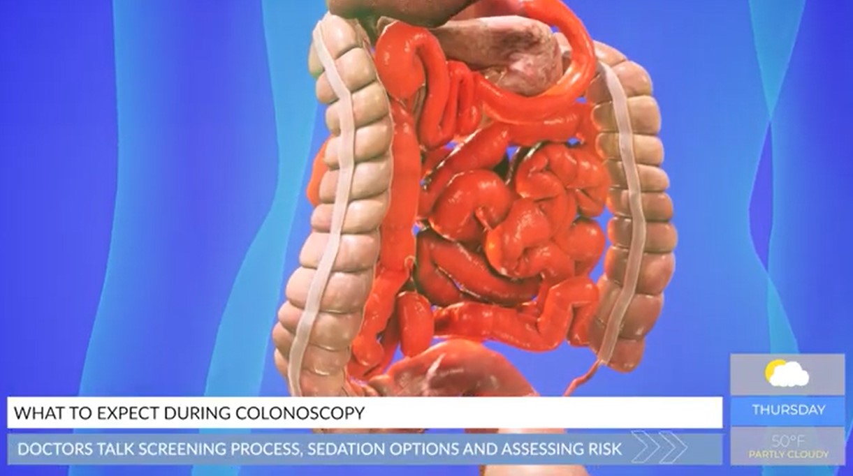 News - Colonoscopy Explained